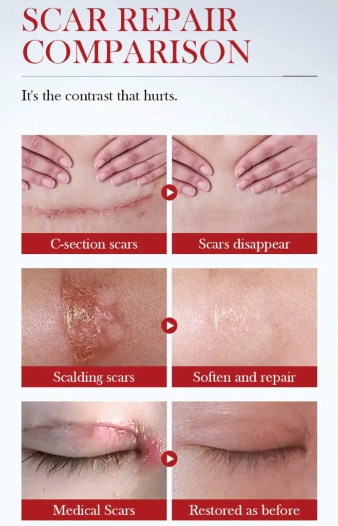 SCAR CREAM WEBSITE (FACEBOOK) 🛑🛑 – Gemherbalremedy.com.ng