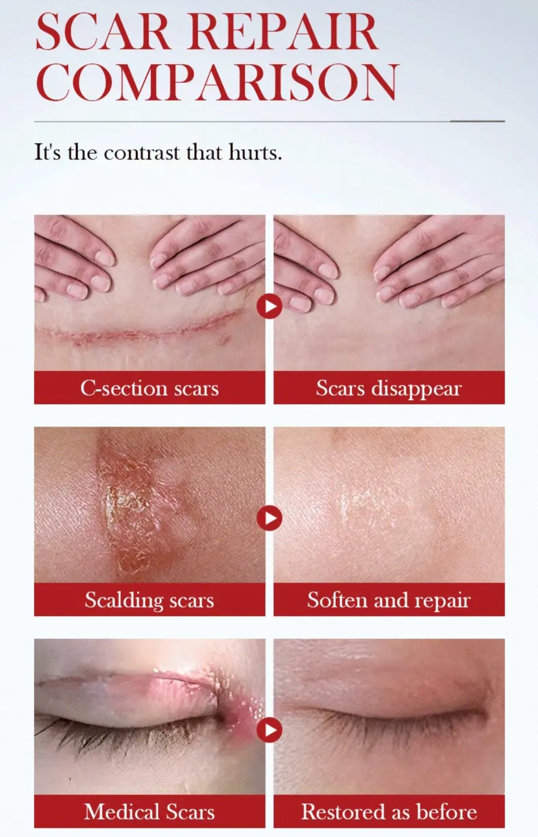 SCAR CREAM WEBSITE (FACEBOOK) 🛑🛑 – Gemherbalremedy.com.ng