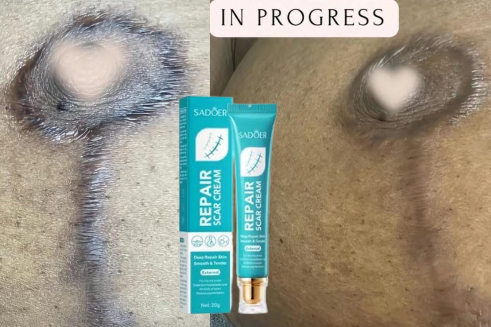 SCAR CREAM WEBSITE – Gem Herbal Remedy